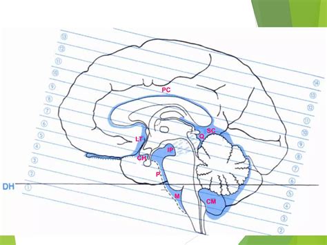 Basal Cisterns Final Ppt