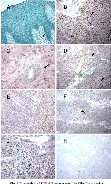 Brian Deer Classification System Semantic Scholar