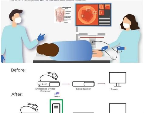 Deepgi Ai A Thai Innovation For The Precision In Colorectal Polyp Detection The Leaders Online