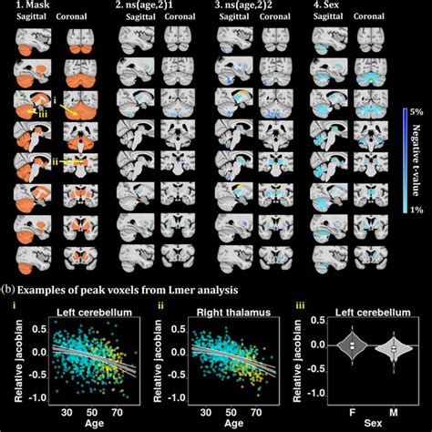 A Brain Slices Of The Brain Highlighting Significant Group