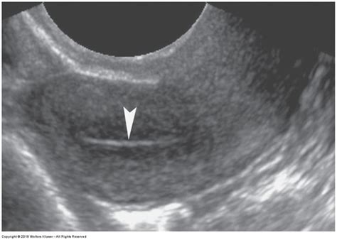 Chapter 20 Flashcards Quizlet