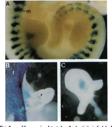 Figure 2 From Mouse Limb Muscle Is Determined In The Absence Of The