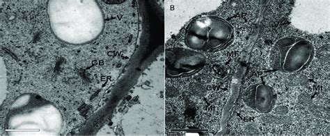Fig Transmission Electron Micrographs Of The Transverse Sections Of