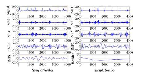 Empirical Mode Decomposition Of The 236 Second Seizure Free Eeg Signal Download Scientific