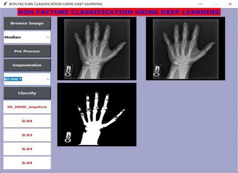 resnet classifier as show in figure when ep1[1] classifier is applied