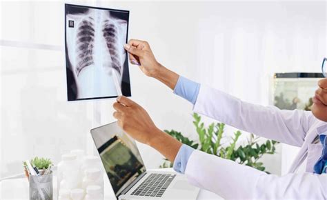 Lung Cancer Everything You Need To Know Sukino