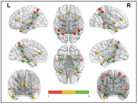 Relationship Between Quality Of Life And The Complexity Of Default Mode Network In Resting State