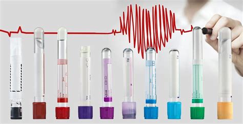 How To Read A Diabetes Lab Report Adw Diabetes