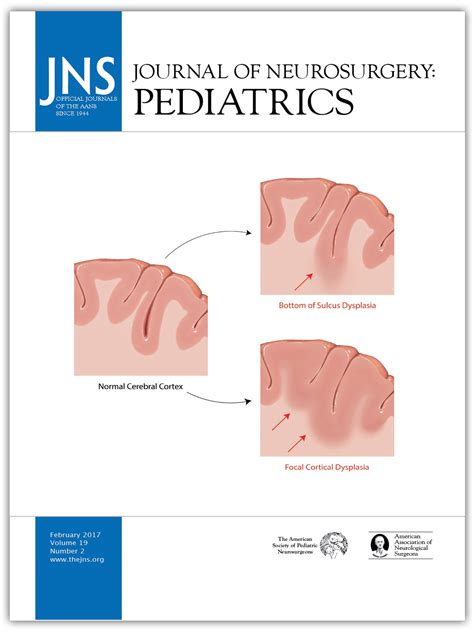 Y Shaped Gluteal Cleft