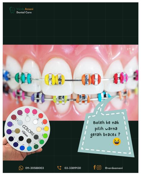 Harga Pasang Braces Swasta Pasang Braces Installment Verde Amani