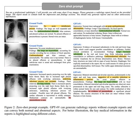 gpt 4v can generate radiology reports without example reports and can