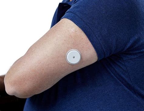 Abbott Freestyle Libre Flash Continuous Glucose Monitoring System