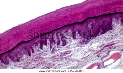 Light Micrograph Showing Skin Over 69 Royalty Free Licensable Stock