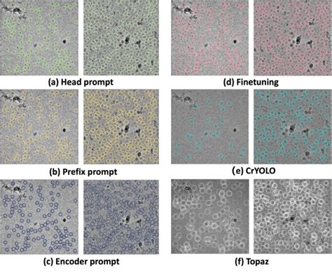 Visualization Of Protein Particle Identification On Three Sample Download Scientific Diagram
