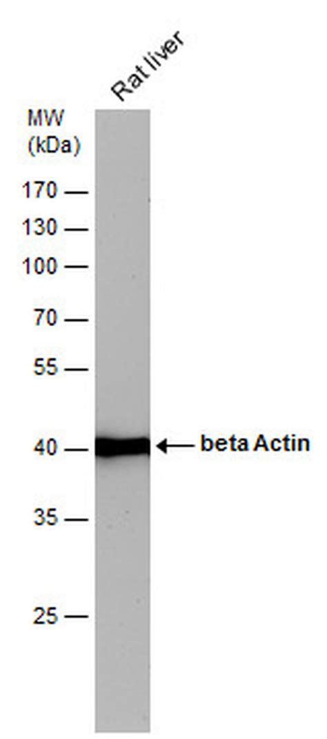 Beta Actin Polyclonal Antibody Invitrogen Pa5 85291