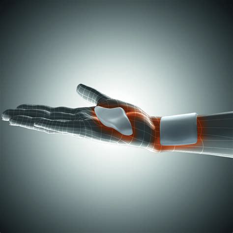 Manu Hit Carpal Ортез для лечения синдрома запястного канала Ортопедический салон мастерская