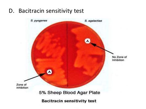 Bacitracin Test Principle Requirements Procedure Results