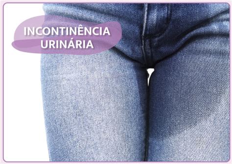 Tratamentos Scope Ginecologia