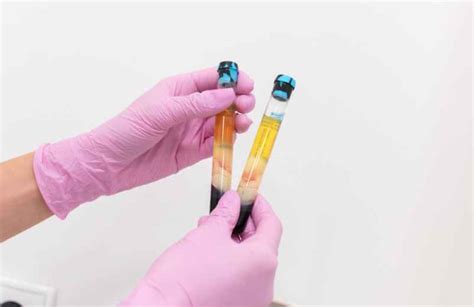 Que Veut Dire Plasma Légèrement Hémolysé Le Tigre Bien Être