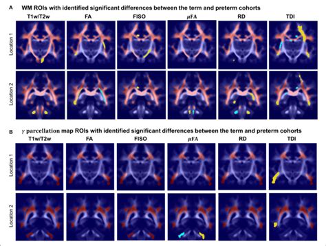 Atlas Based Region Specific Analysis The Regions Significantly