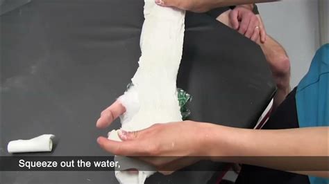 Posi Position Of Safe Immobilisation Backslab Youtube