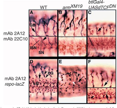 Figure 3 From Wingless And Its Signalling Pathway Have Common And Separable Functions During