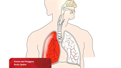 Detail Gambar Alat Pernapasan Pada Manusia Koleksi Nomer 25