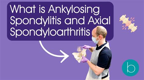 What Is Ankylosing Spondylitis And Axial Spondyloarthritis Youtube