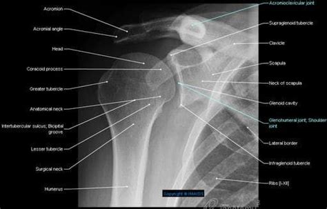 Shoulder Pectoral Girdle Shoulder Girdle Radiography Human