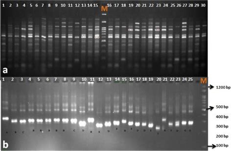 PCR Amplification Profile Obtained With SRAP Marker Em2 Me1 A And