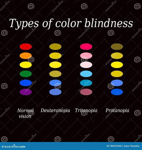 Types Of Color Blindness Eye Color Perception Vector Illustration On