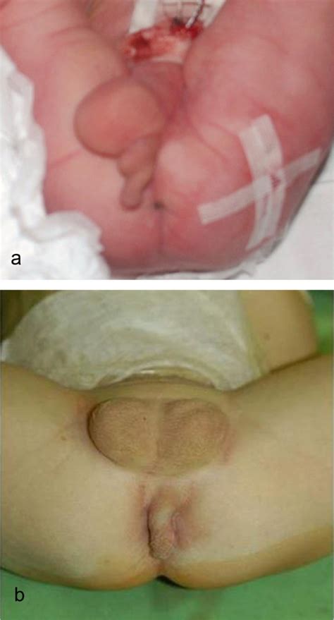 Elements Of Morphology Standard Terminology For The External Genitalia PMC