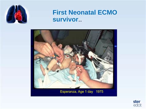 Ecmo Presentation Final Ppt
