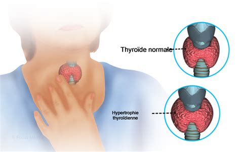 Health Condition Symptoms Causes Treatment And More