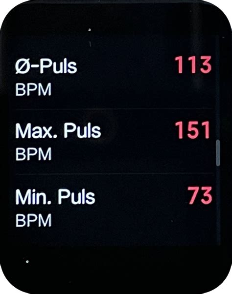 Xiaomi Mi Watch Lite Review What Can The Affordable Smartwatch Do And What Differentiates It