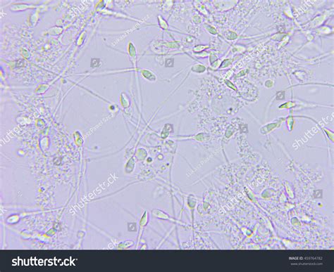 Microscopic View Of Sperm