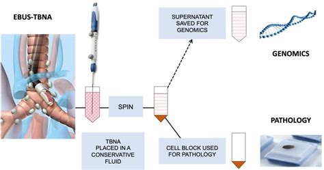 Alternative Handling Of Cytology Specimens For Genomics Using