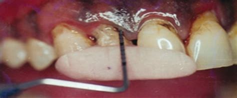 A Comparative Evaluation Of Atrigel Delivery System 10 Dox