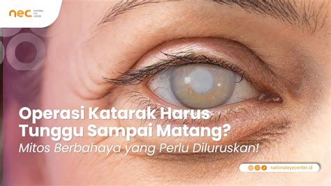 9 Ciri Ciri Mata Katarak Dan Cara Mengobatinya