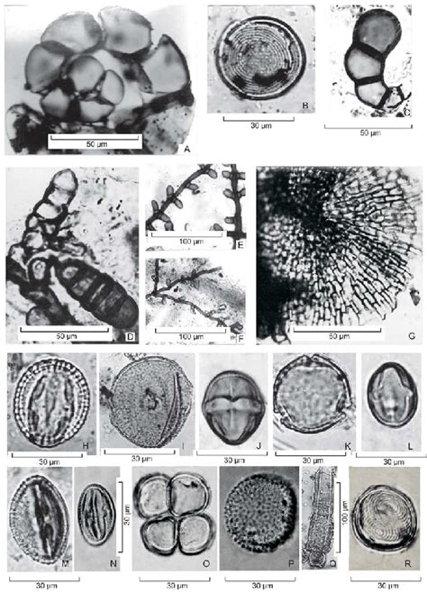 A Marine To Brackish Water Benthonic Microforaminifera Ammonia Sp