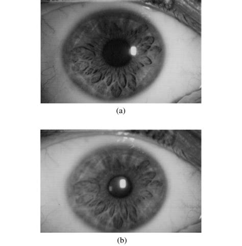 variation in pupil size when the light beam is more focused into the