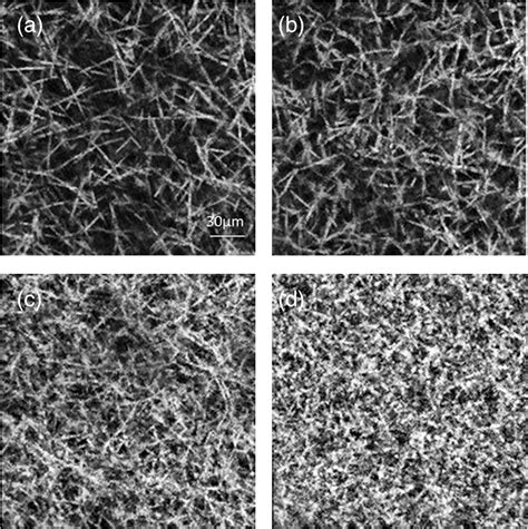 Dynamic Multicomponent Engineered Tissue Reorganization And Matrix Deposition Measured With An