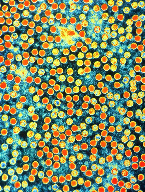 Polio Virus Under Microscope