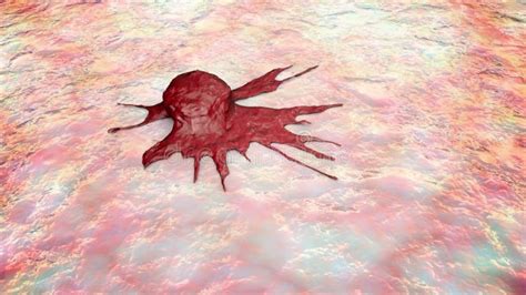 Cancer Growth Animation Showing Tumor Growth And Spread Stock Footage