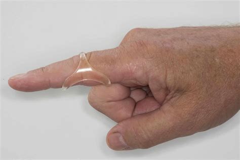 Boutonniere Finger Boutonniere Deformity Finger Splint
