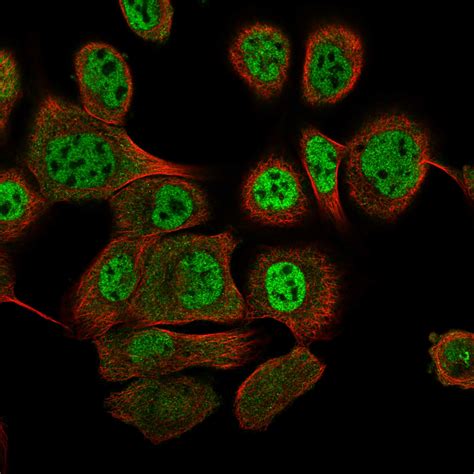 Subcellular Hdac6 The Human Protein Atlas