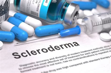 Scleroderma Diagnosis Medical Concept Composition Of Medicaments