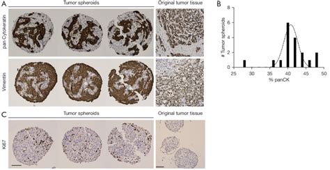 IHC Staining Of Breast Cancer Spheroids Reveals The Distribution Of
