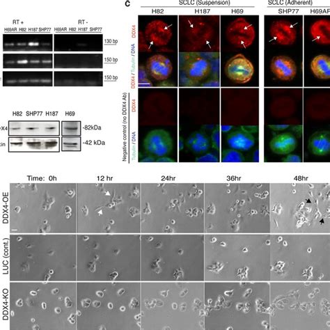 Ddx4 Is Expressed In Several Sclc Cell Lines A Rt Pcr Results Of Four