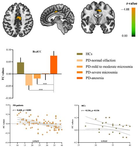 Brain Sciences Free Full Text Association Between Functional